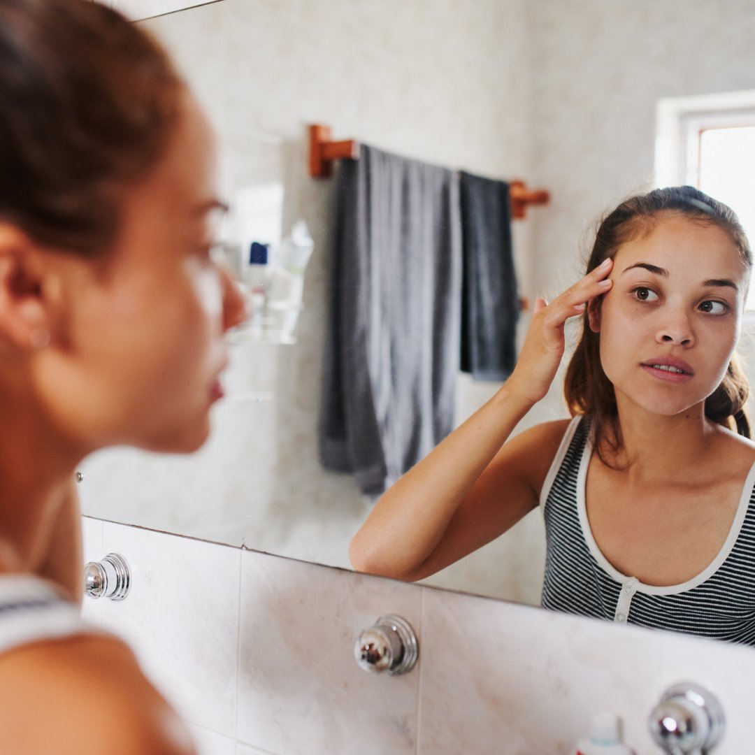 How to get rid of Stubborn Skin Texture – Monday Muse