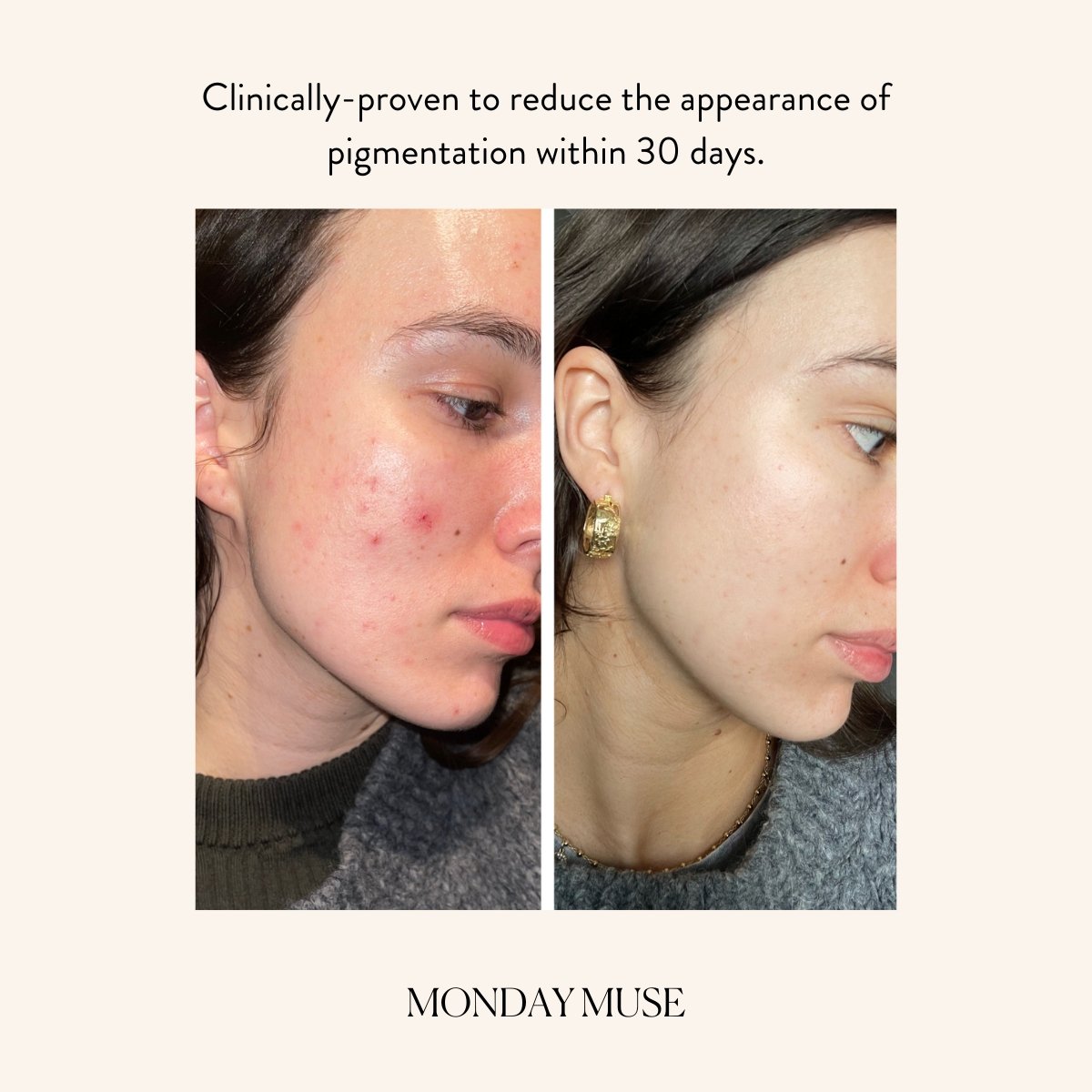 The Powder - Dark Spot Enzyme Exfoliant – Monday Muse